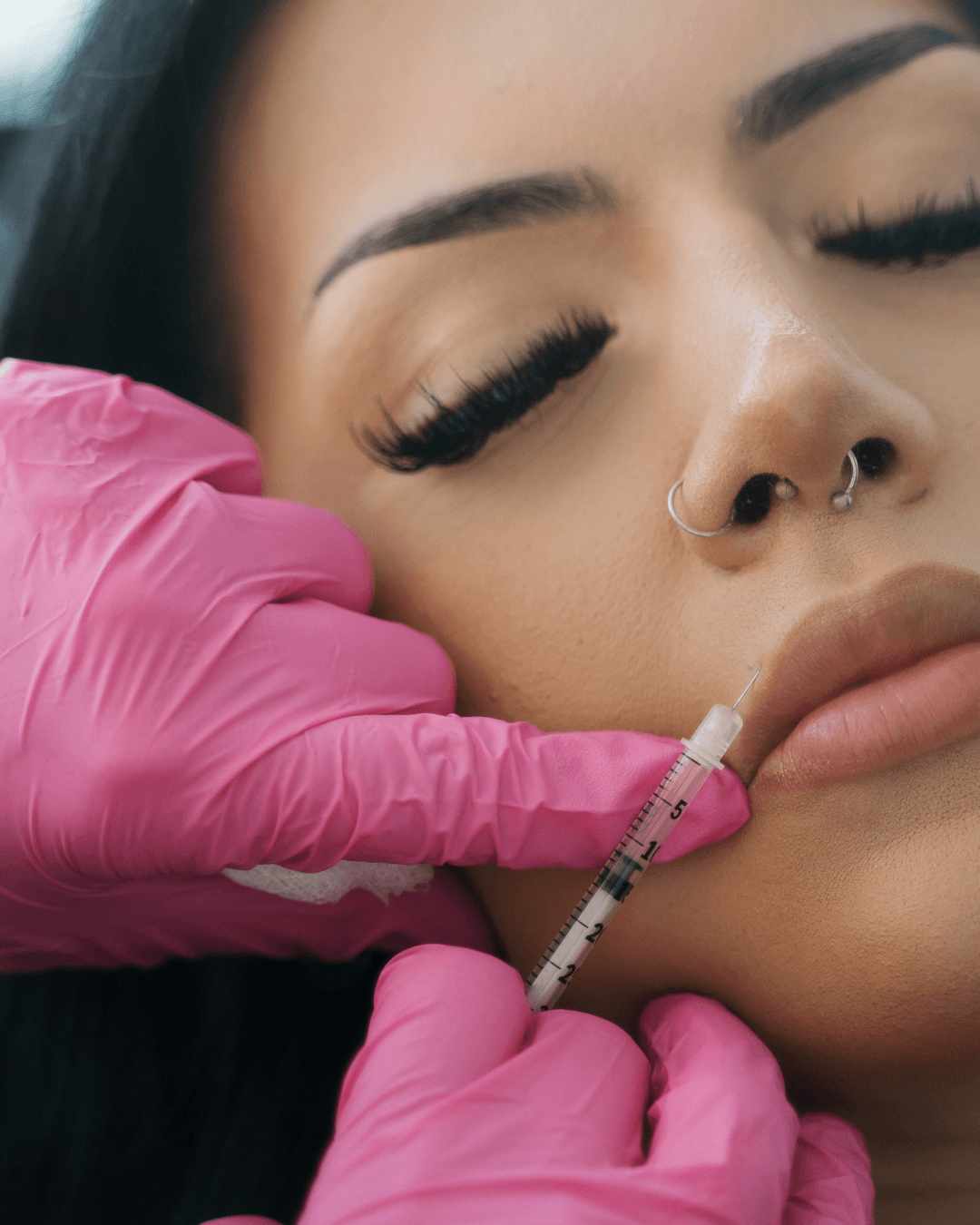Dermal Fillers Crown Point | Crown Med Spa